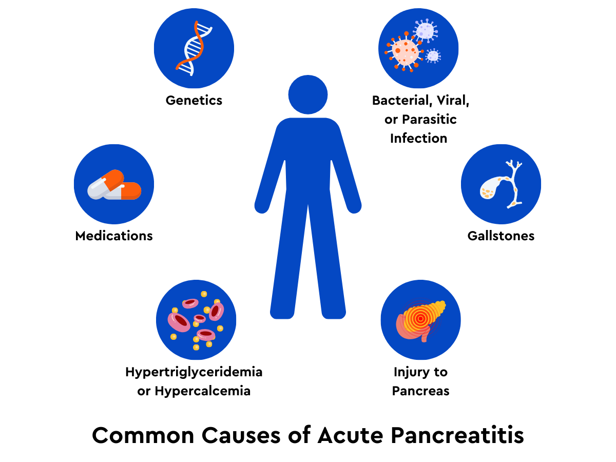 Acute Pancreatitis - Mission:Cure